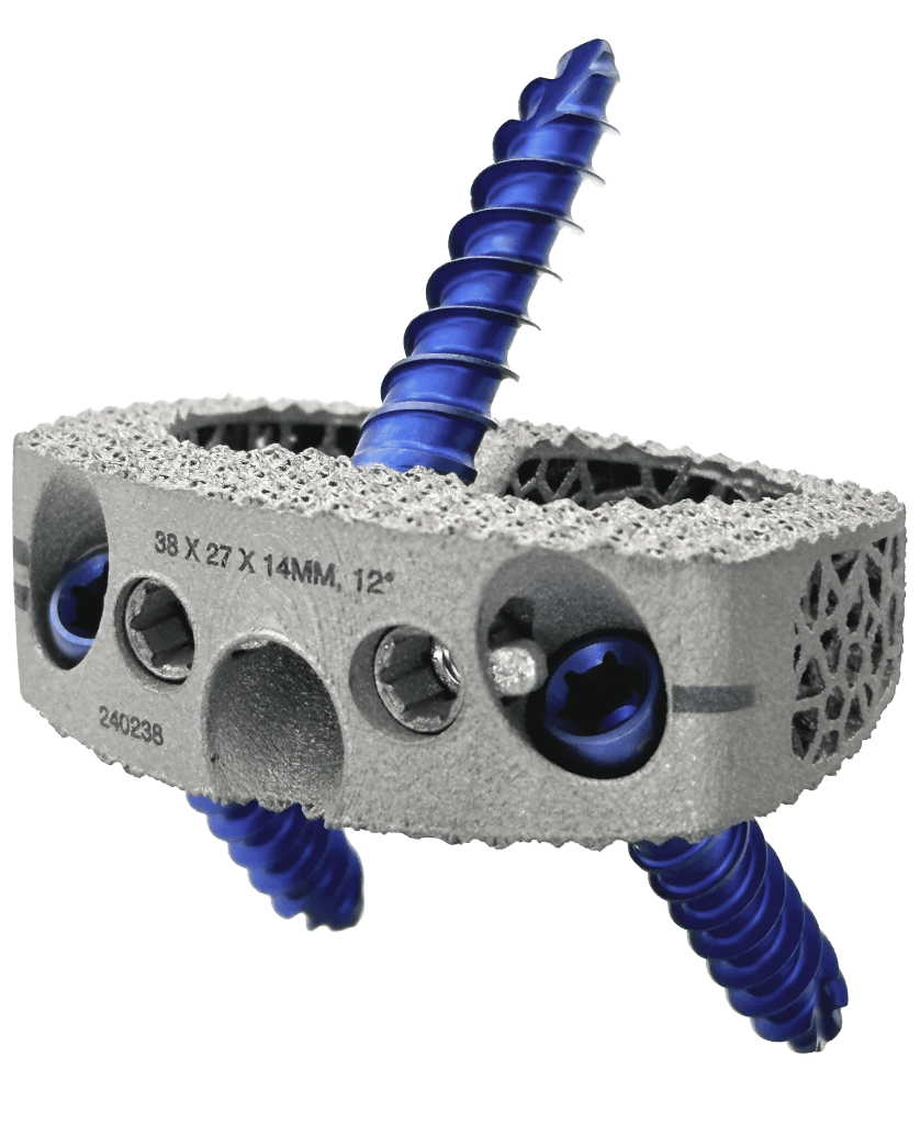 ProAM ALIF – Pro Surgical